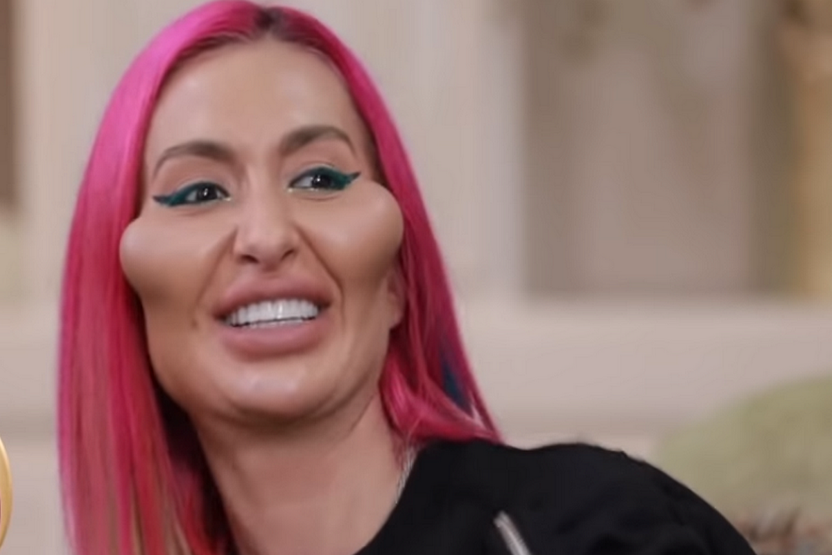 Modelka s největšími lícními kostmi na světě znovu podstoupila ...