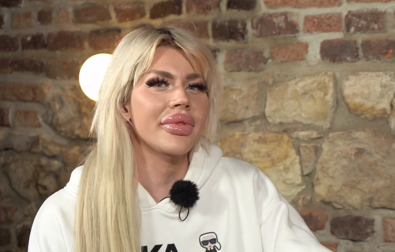 Jan Šimša prozradil, jakou další plastickou operaci chce podstoupit ...