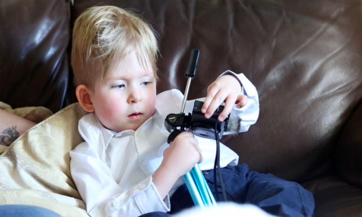 Kluk se narodil téměř bez mozku: Jak vypadá díte za pět let od narození ...