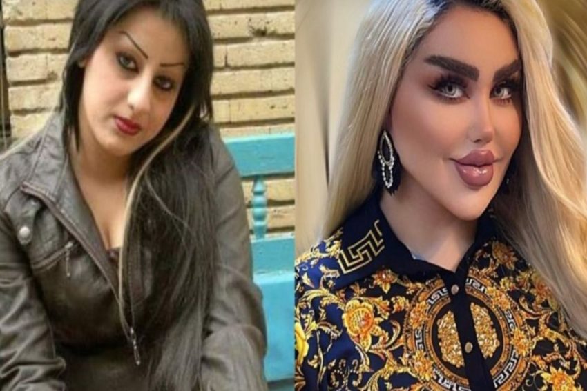 Žena podstoupila 43 operací, aby vypadala jako Barbie: Jak vypadala ...